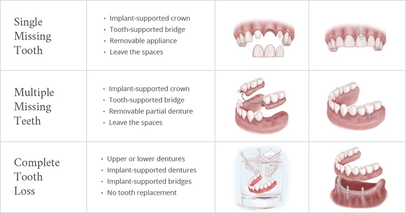 Treatment Options | Oral Surgery Partners Treatment Options | Oral Surgery Partners